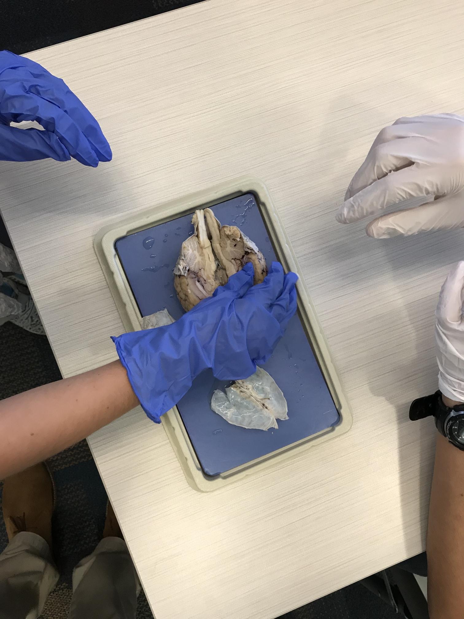 Brain Dissection Workshop! | San Diego Festival of Science & Engineering